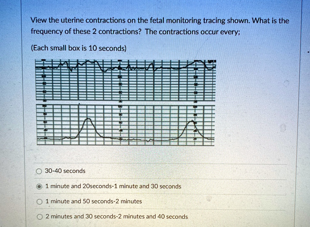 view the uterine contractions on the fetal monitoring tracing shown ...