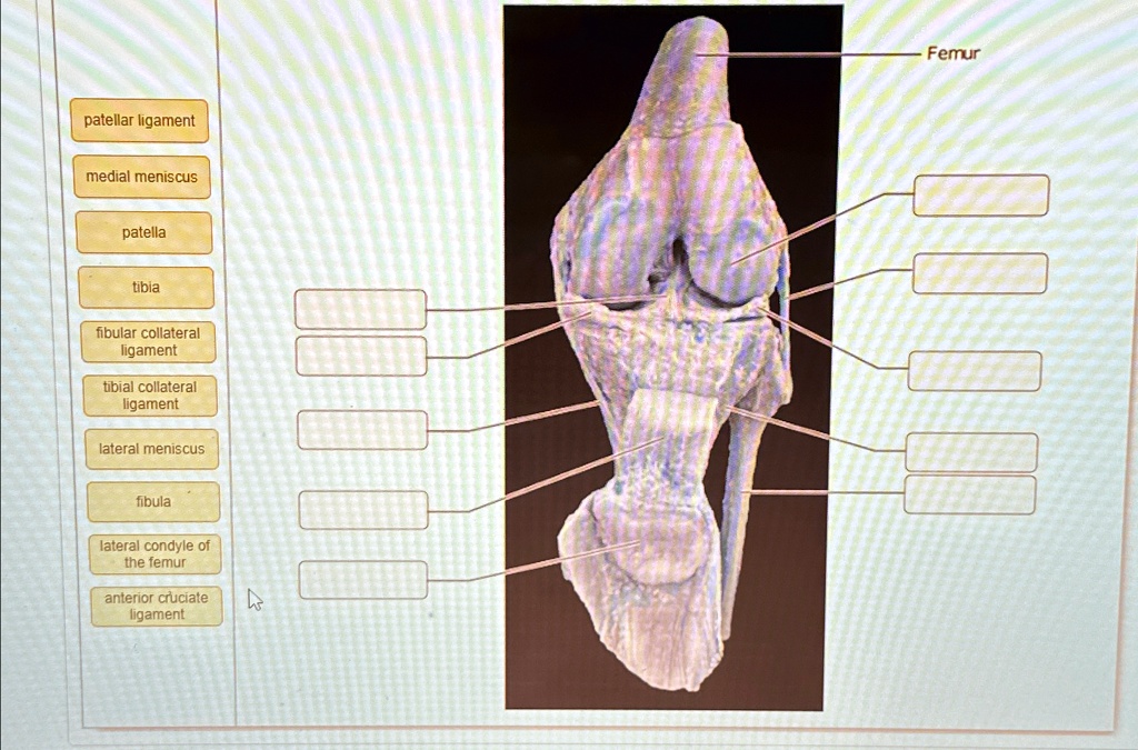 I need help with this label for anatomy 1! Femur patellar ligament ...