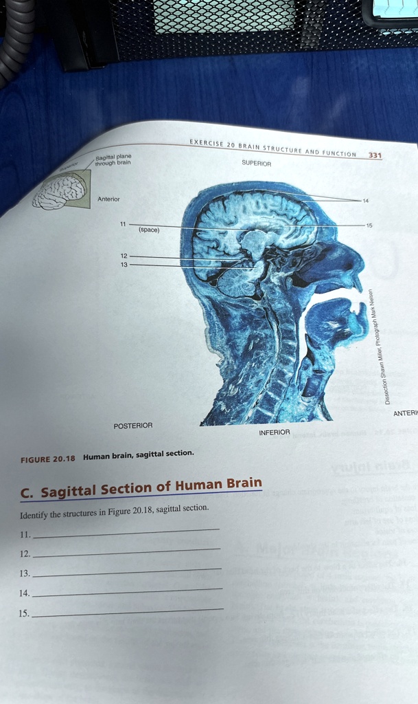 EXERCISE 20 BRAIN STRUCTURE AND FUNCTION 331 Sagittal plane through ...