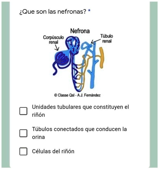 SOLVED: ayudaaa plis doy corona iQue son las nefronas Nefrona ... SOLVED: ayudaaa plis doy corona iQue son las nefronas Nefrona ...