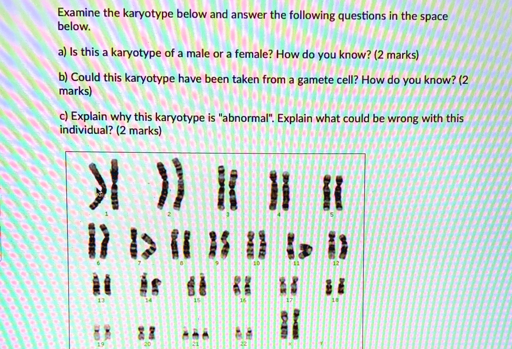 examine the karyotype below and answer the following questions in the ...