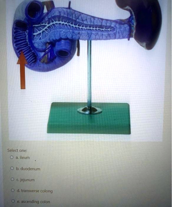 SOLVED: ileum b: duodenum c: jejunum d: transverse colon ascending colon