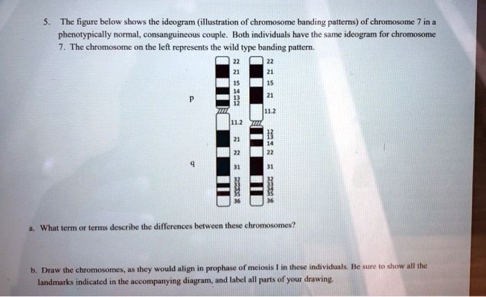 The figure below shows the ideogram (illustration of chromosome banding ...