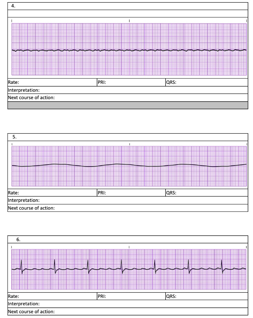 SOLVED: What is the rate, PR interval, QRS interval? Interpretation - which will be one of the ...