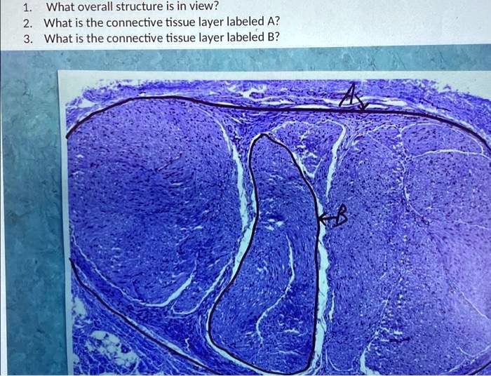 1. What overall structure is in view? 2. What is the connective tissue ...