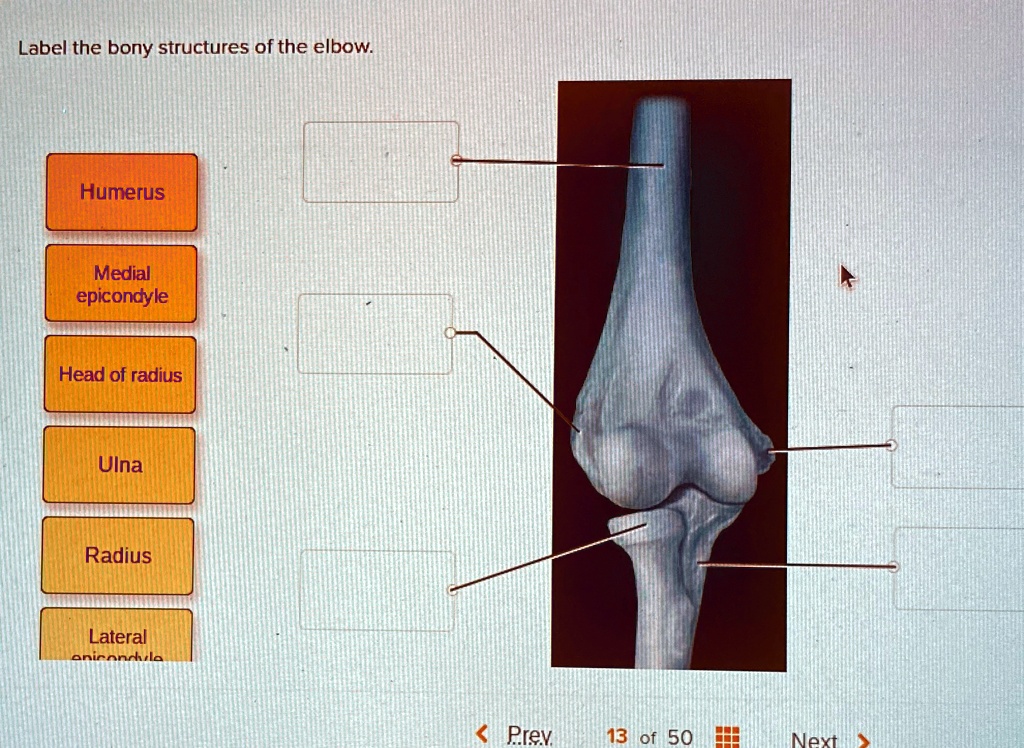 label the bony structures of the elbow humerus medial epicondyle head of radius ulna radius ...