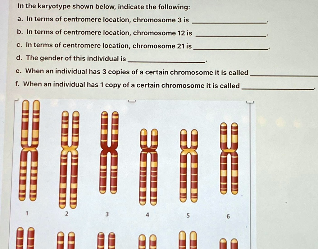 SOLVED: In the karyotype shown below, indicate the following: a. In ...