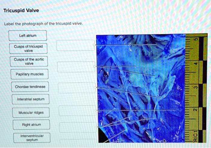 Tricuspid Valve Label the photograph of the tricuspid valve. Left ...