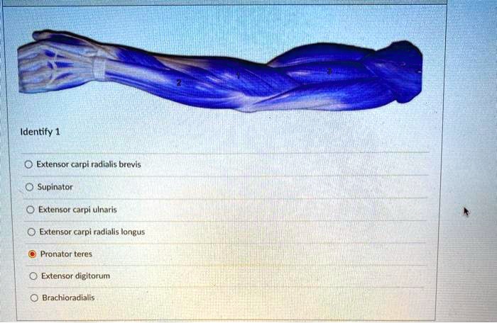 Identify 1 Extensor carpi radialis brevis Supinator Extensor...