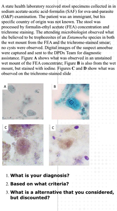 SOLVED: A state health laboratory received stool specimens collected in ...