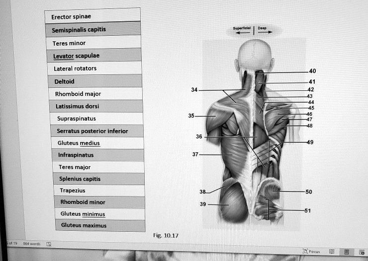 SOLVED: Erector spinae Semispinalis capitis Teres minor Levator ...