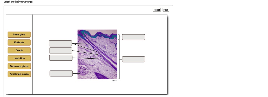 Label the hair structures. Sweat gland Epidermis Dermis Hair follicle ...