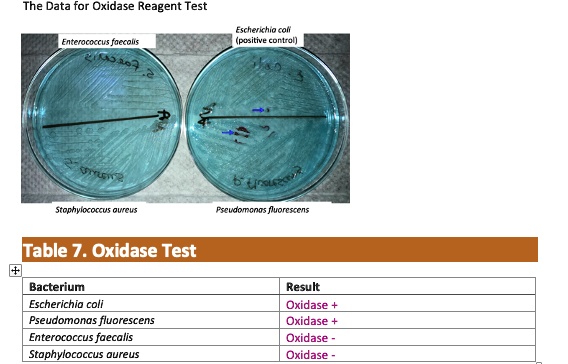 SOLVED: The Data for Oxidase Reagent Test Escherichia coli positive ...