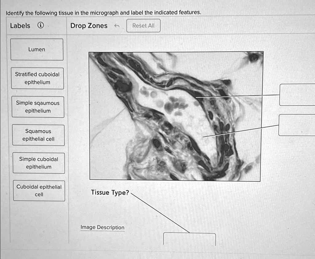 SOLVED: Identify the following tissue in the micrograph and label the indicated features. Labels ...