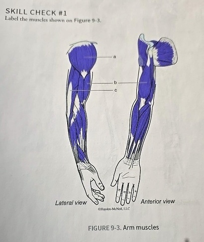 skill check 1 label the muscles shown on figure 9 3 a b c lateral view ...