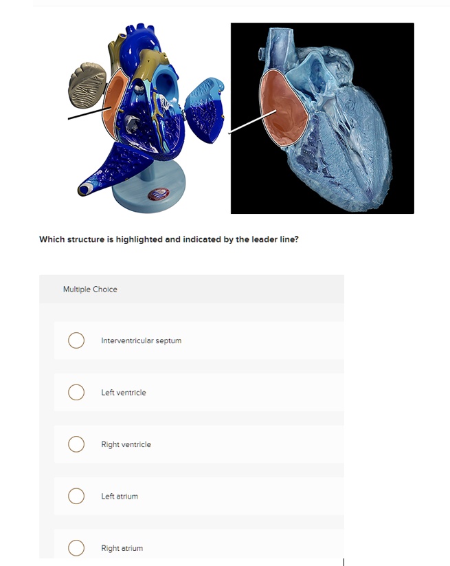 Which structure is highlighted and indicated by the leader line? Multiple Choice ...