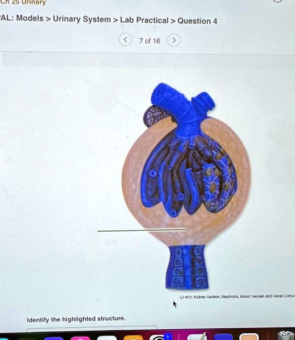 VIDEO solution: 25 Urinary PAL: Models > Urinary System > Lab Practical ...