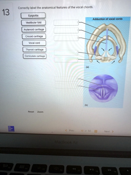 SOLVED: Correctly Label The Anatomical Features Of The, 49% OFF SOLVED: Correctly Label The Anatomical Features Of The, 49% OFF