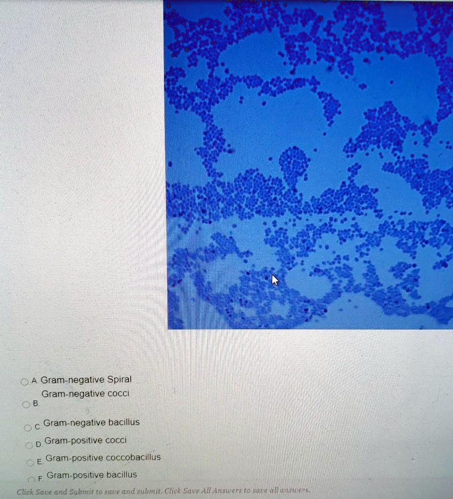 SOLVED: Select Apply A Gram-negative Spiral Gram-negative cocci Gram-negative bacillus Gram ...