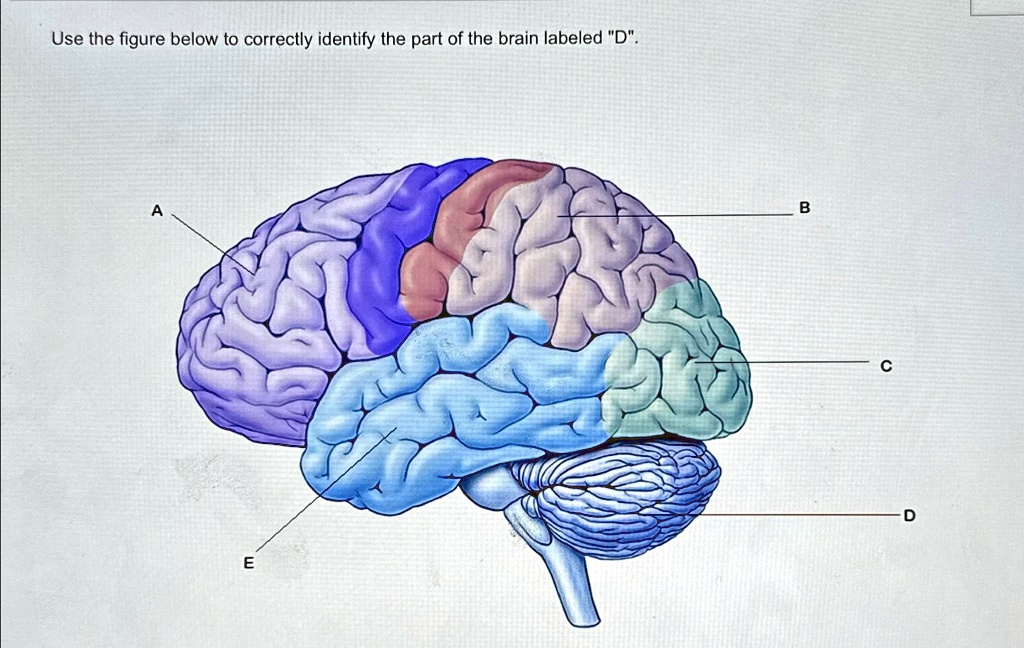 Use the figure below to correctly identify the part of the brain ...