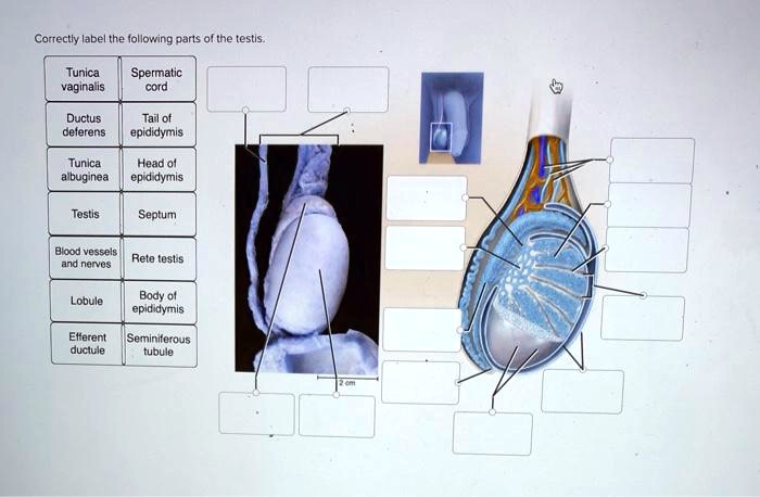 Correctly label the following parts of the testis. Tunica vaginalis ...