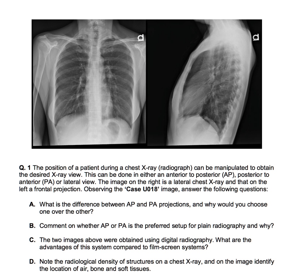 SOLVED: The position of a patient during a chest X-ray (radiograph) can ...