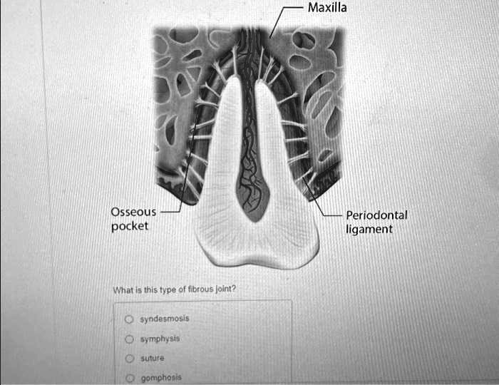 Osseous pocket What is this type of fibrous joint? syndesmosis ...
