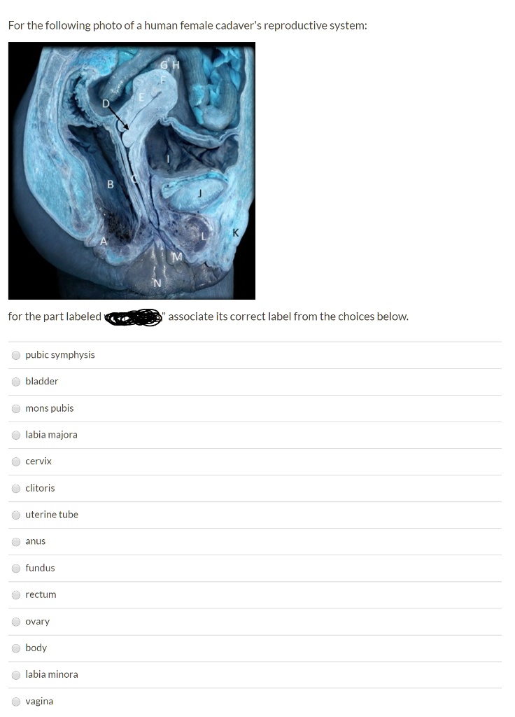 For the following photo of a human female cadaver's reproductive system ...