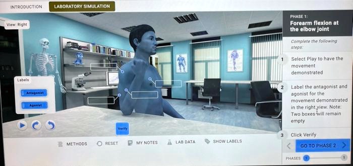 SOLVED: Text: Forearm flexion at the elbow joint. Label the antagonist and agonist for the ...