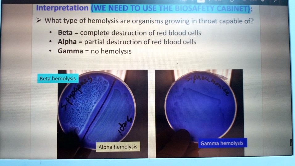 Interpretation we need to use the biosafety cabinet what...