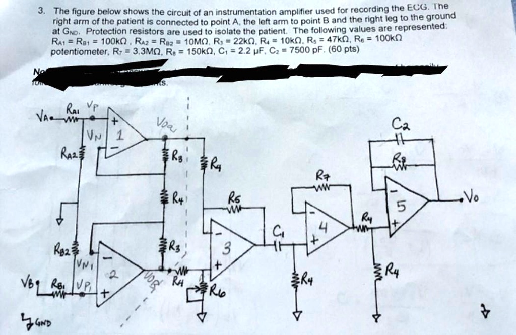 SOLVED: The figure below shows the circuit of an instrumentation ...