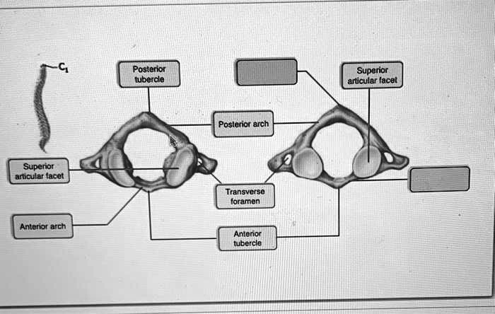 Posterior tubercle Superior articular facet Posterior arch Superior ...