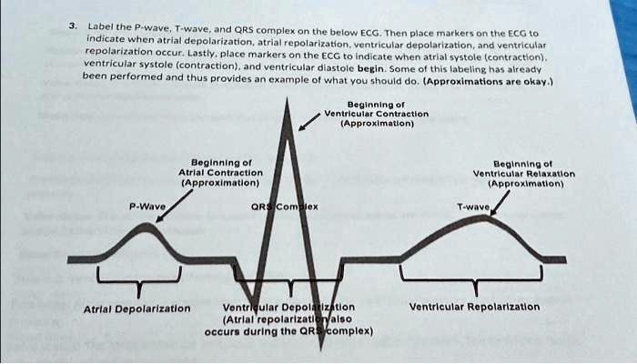 3. Label the P-wave, T-wave, and QRS complex on the below ECG. Then ... 3. Label the P-wave, T-wave, and QRS complex on the below ECG. Then ...