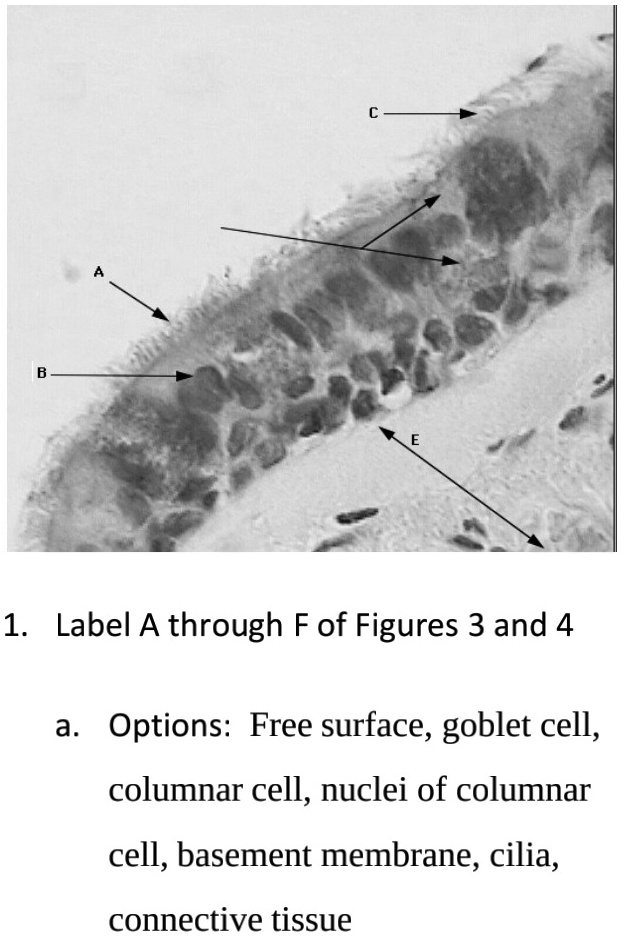 SOLVED: 13 Label A through F of Figures 3 and 4 a Options: Free surface, goblet cell; columnar ...