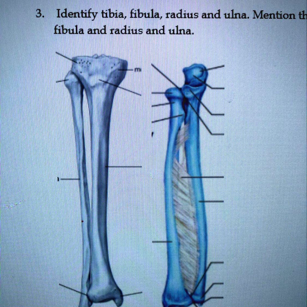 SOLVED: 'What difference between structure of radius ,ulna and fibula ... SOLVED: 'What difference between structure of radius ,ulna and fibula ...