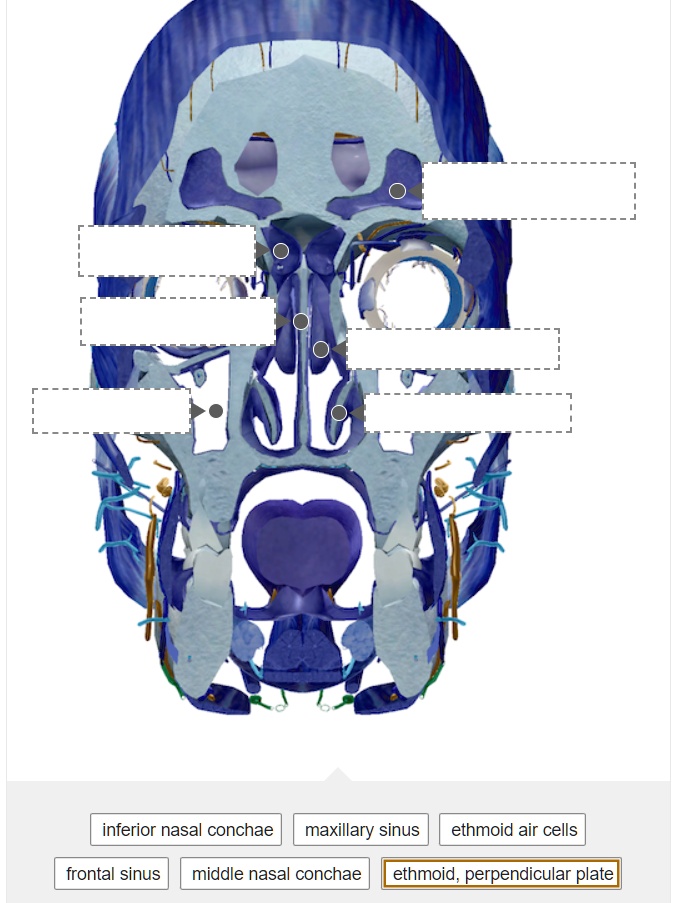 SOLVED: Label the image. inferior nasal conchae maxillary sinus ethmoid ...