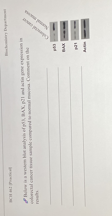 Biochemistry Department BCH 4S2 |Rractical) f f Below is a western blot ...