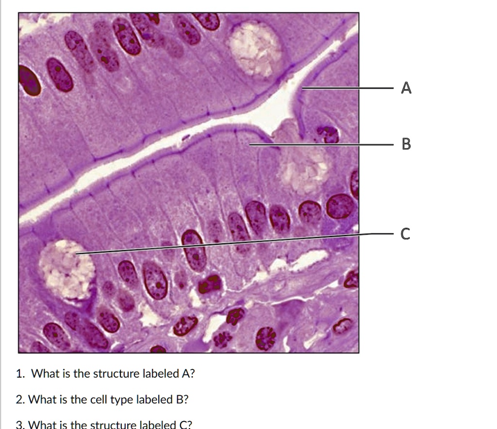 SOLVED: A B c 1. What is the structure labeled A? 2. What is the cell ...
