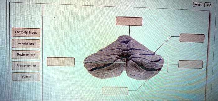 SOLVED: Horizontal fissure Anterior lobe Posterior lobe Primary fissure Vermis