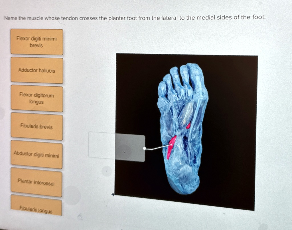 Name the muscle whose tendon crosses the plantar foot from the lateral ...