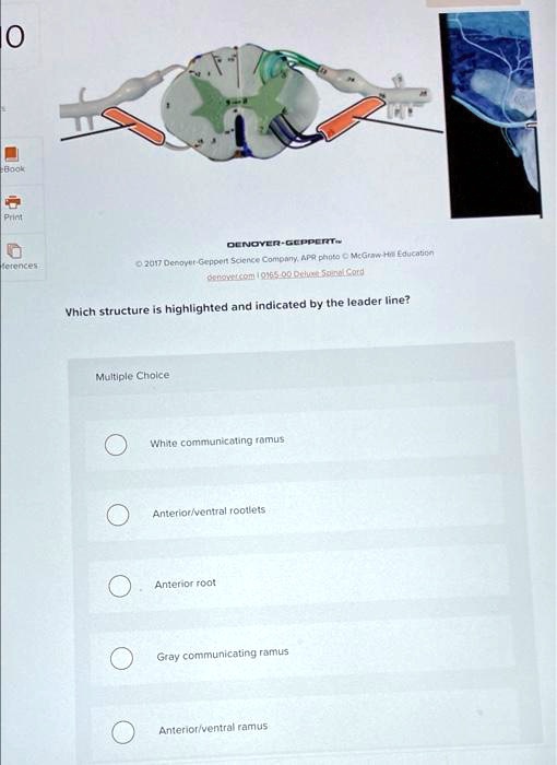 SOLVED: DENOYER-GEPPERT. References Â©2017 Denoyer-Geppert Science Company. APR photo Â© McGraw ...