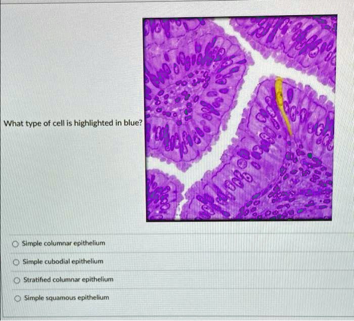SOLVED: What type of cell is highlighted in blue? - Simple columnar epithelium - Simple cuboidal ...