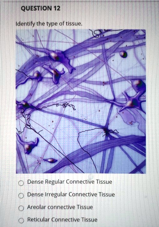 SOLVED: QUESTION 12 Identify the type of tissue: Dense Regular ... SOLVED: QUESTION 12 Identify the type of tissue: Dense Regular ...