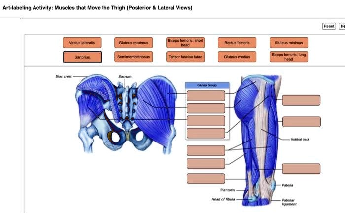 SOLVED: Texts: label properly label. The picture is crystal clear and ...