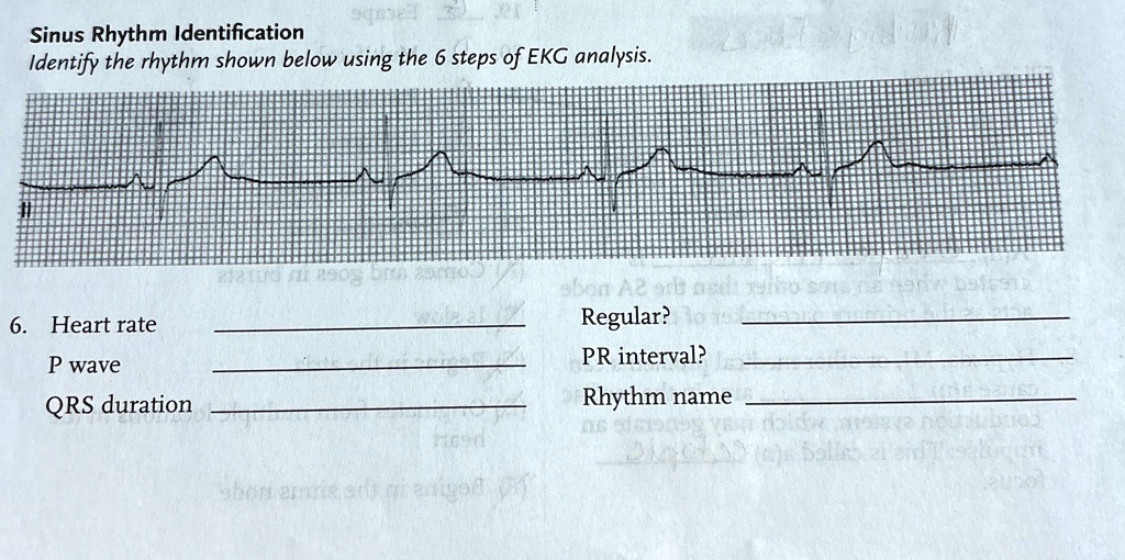 sinus rhythm identification identify the rhythm shown below using the 6 ...