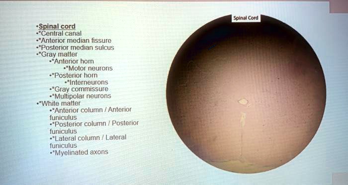 •Spinal cord •Central canal •Anterior median fissure •Posterior median ...
