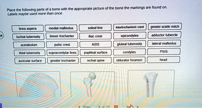 Place the following parts of a bone with the approprlate...