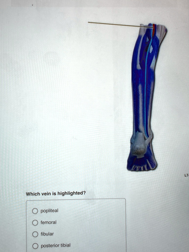which vein is highlighted popliteal femoral fibular posterior tibial ...