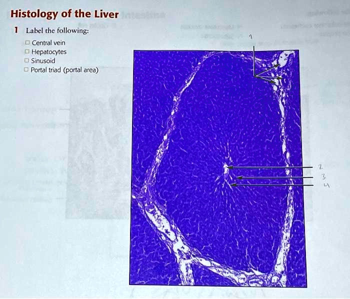 SOLVED: Histology of the Liver Label the following: Central vein ...