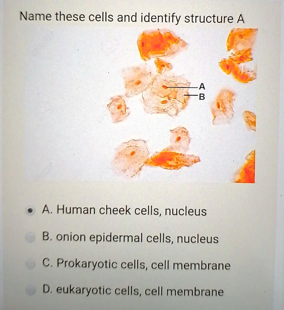 SOLVED:Name these cells and identify structure A 78 A. Human cheek ... SOLVED:Name these cells and identify structure A 78 A. Human cheek ...